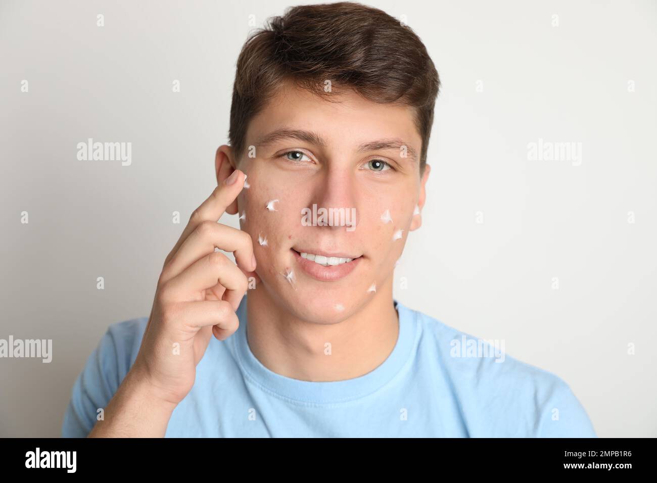 Teen guy with acne problem applying cream on light background Stock ...
