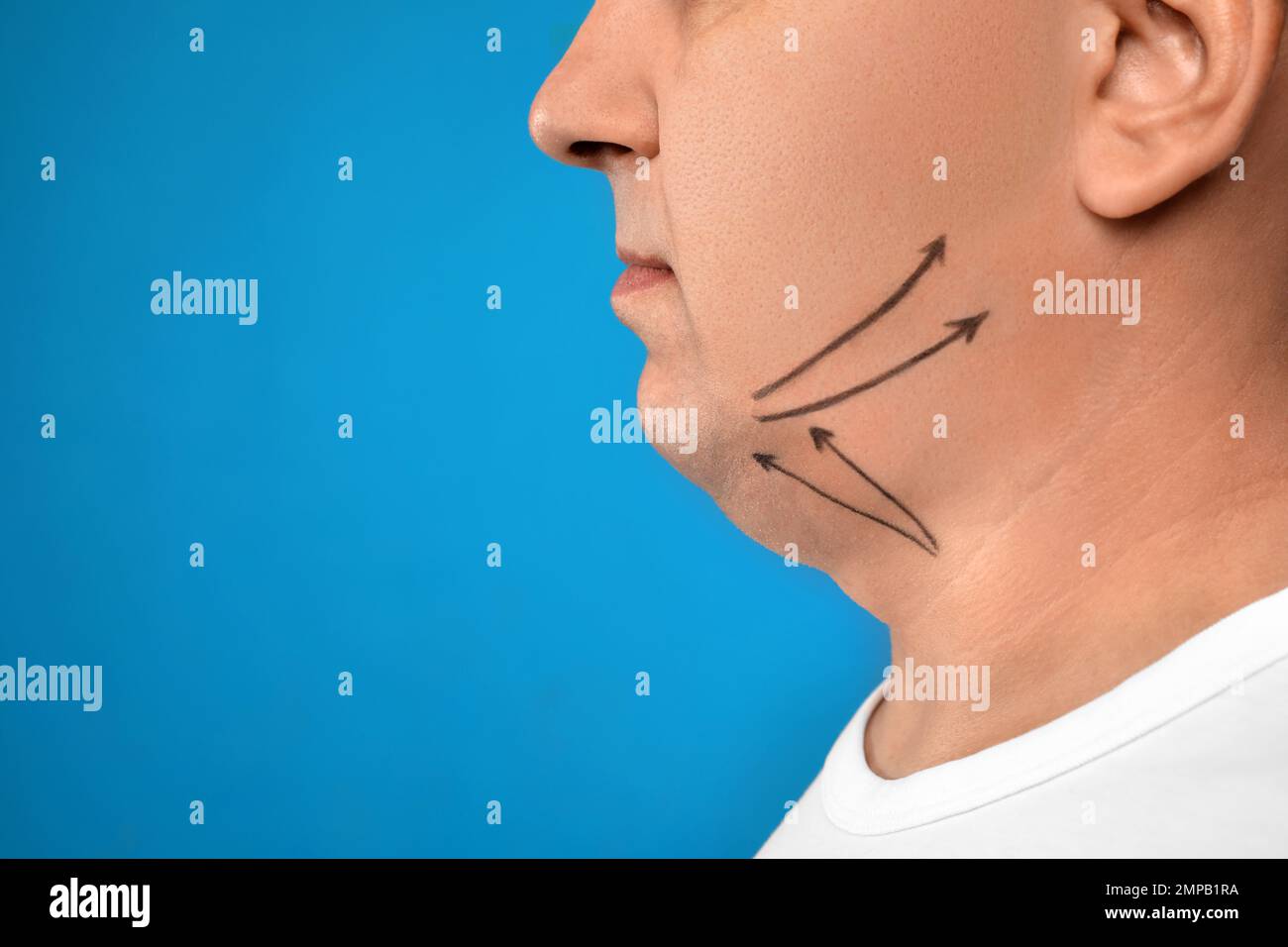 Mature man with marks on face against blue background, closeup. Double ...