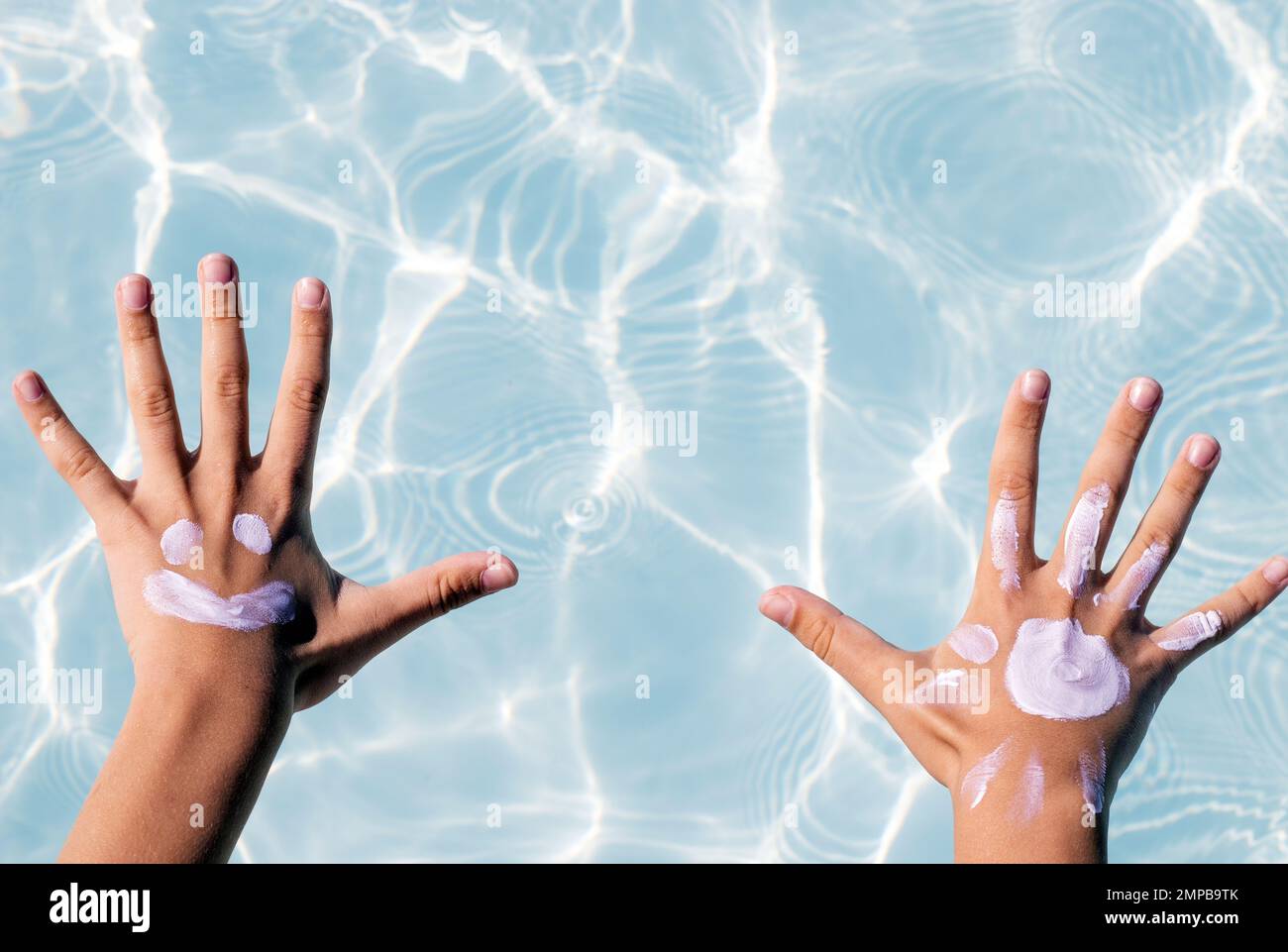 Red skin sunburn beach hi-res stock photography and images - Alamy