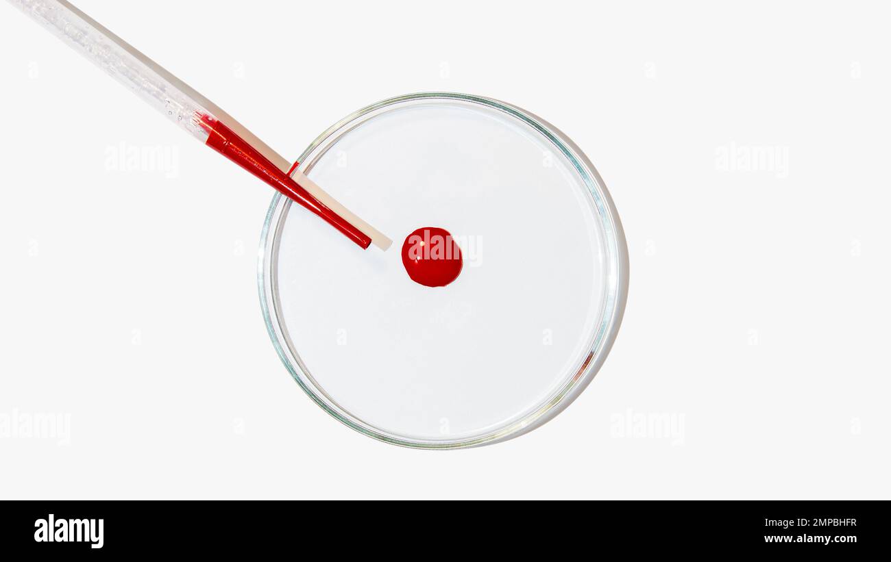 Petri dish on a light background. A drop of blood. Laboratory test, dna ...