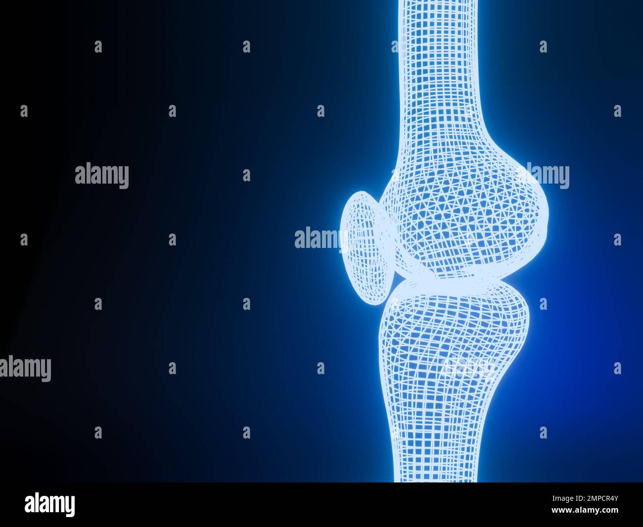 Knee joint 3D rendering Blue glowing wireframe on black background with ...