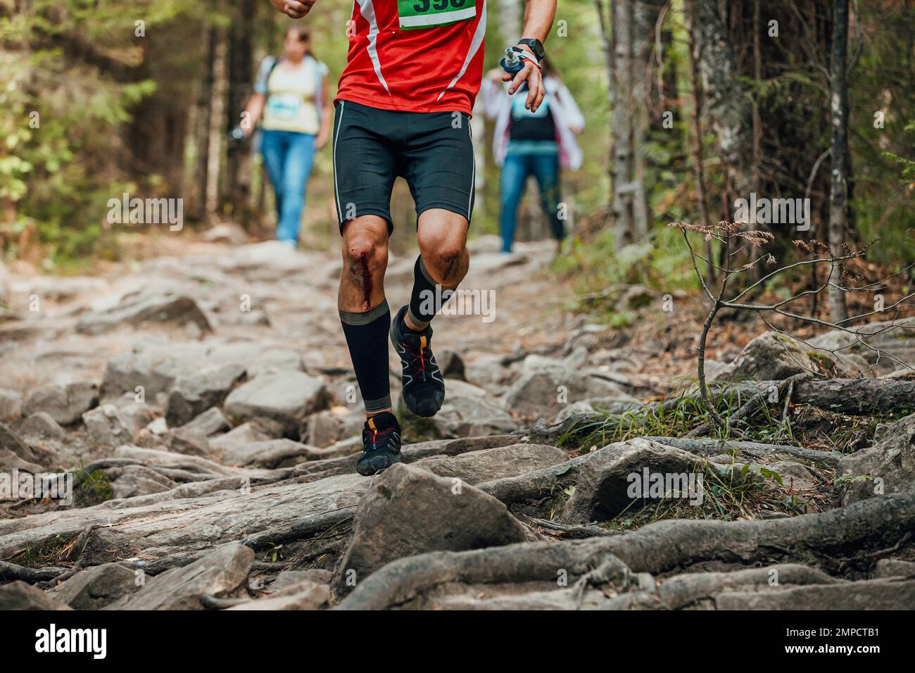 athlete runner with blood on his knees run forest trail Stock Photo - Alamy