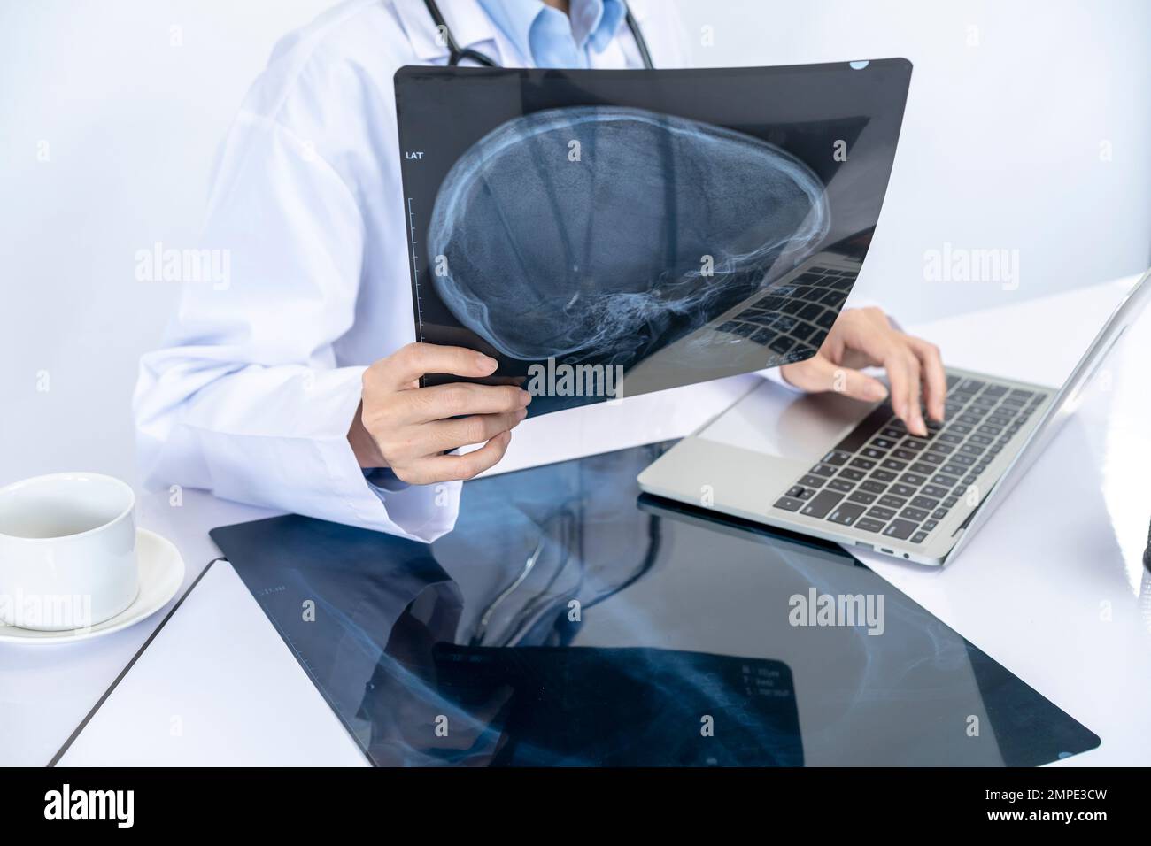 Female doctor check film x-ray image from machine. Analyze a progress ...