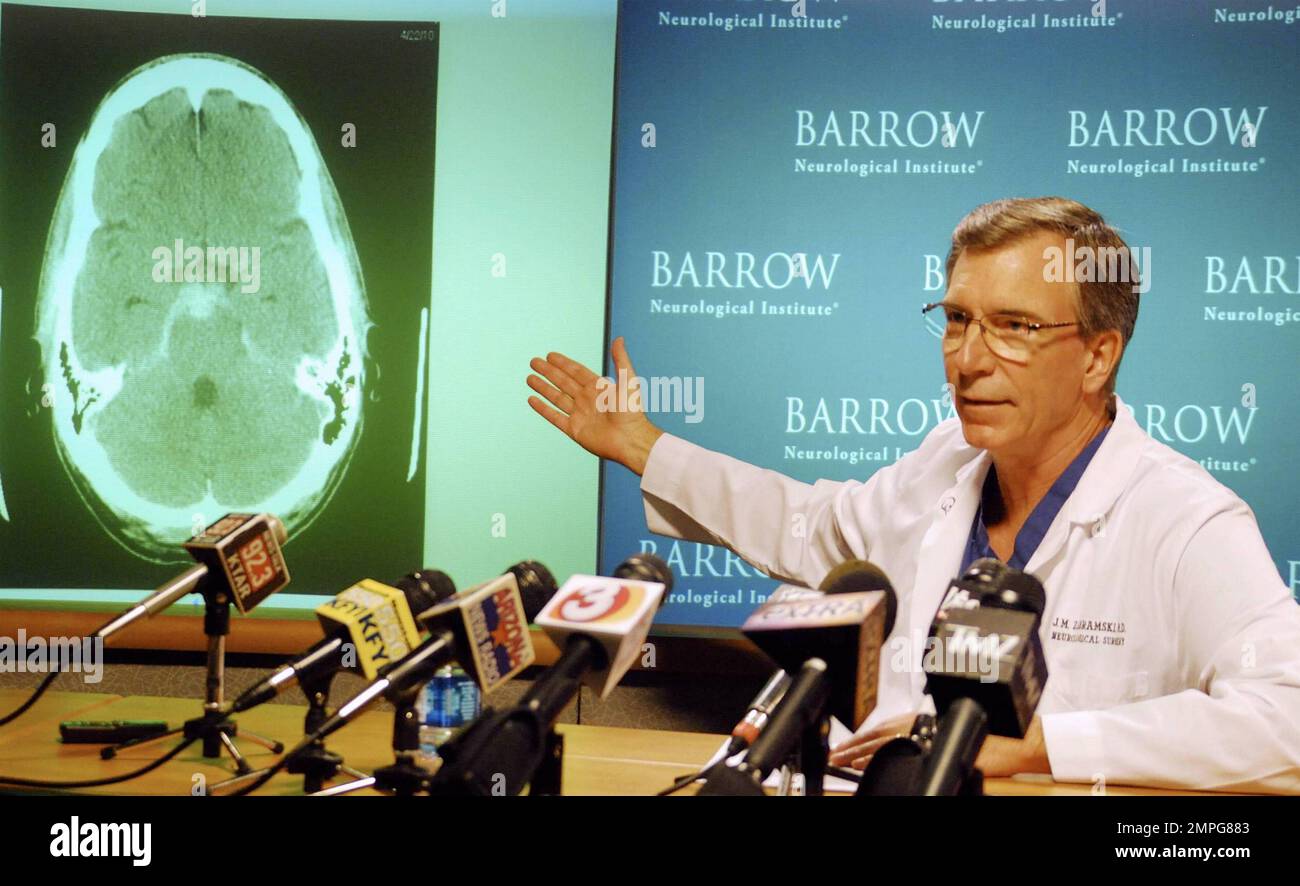 Dr Joseph Zabramski of the Barrows Neurological Institute at St Josephs ...