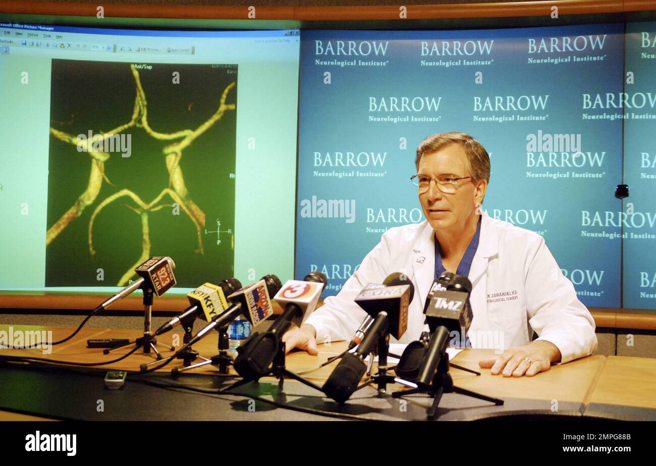 Dr Joseph Zabramski of the Barrows Neurological Institute at St Josephs ...