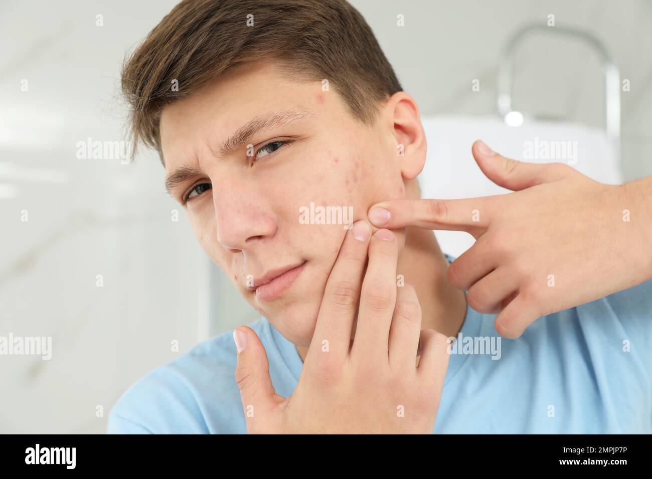 Teen guy with acne problem squeezing pimple in bathroom Stock Photo - Alamy