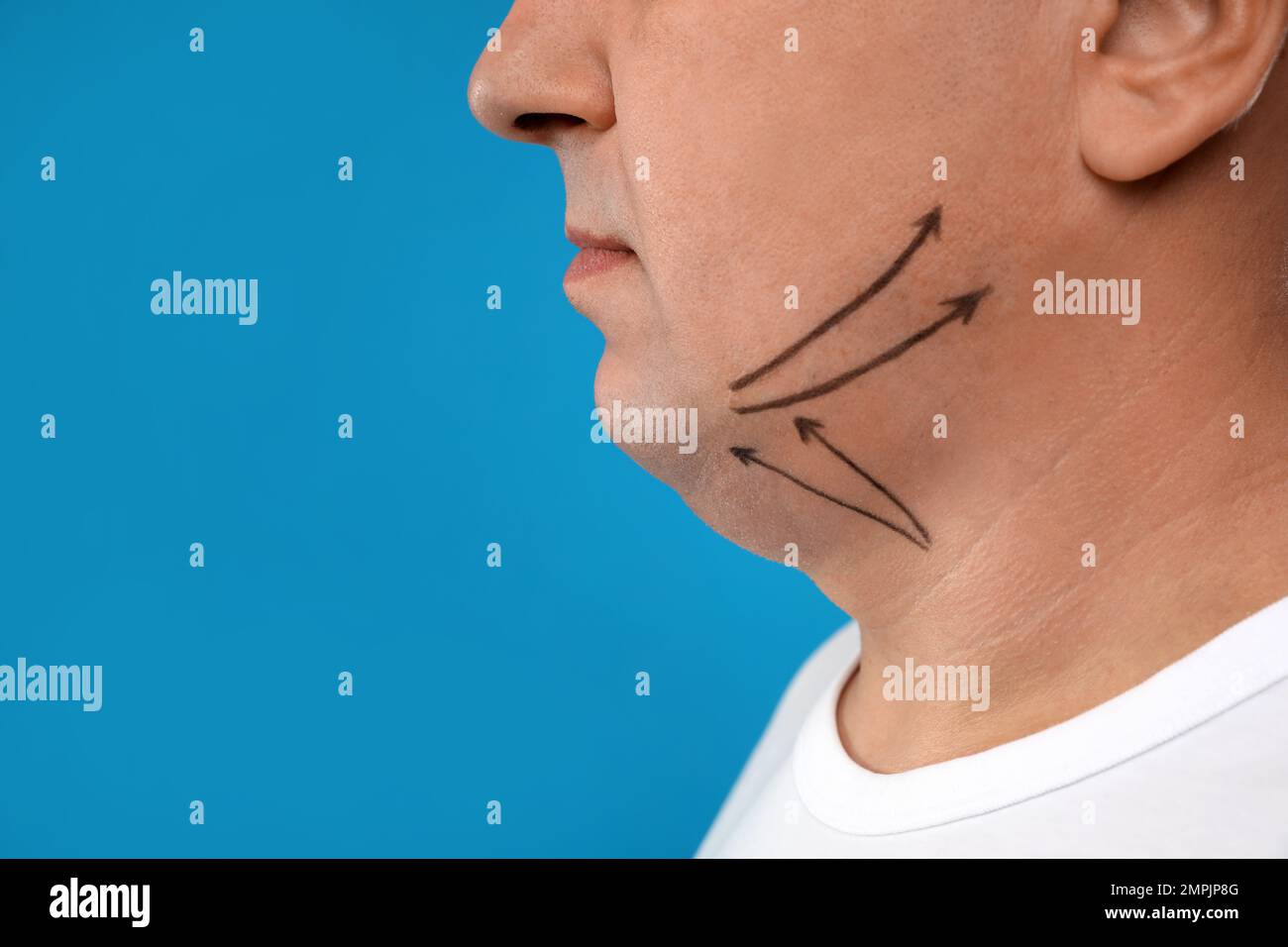 Mature man with marks on face against blue background, closeup. Double ...
