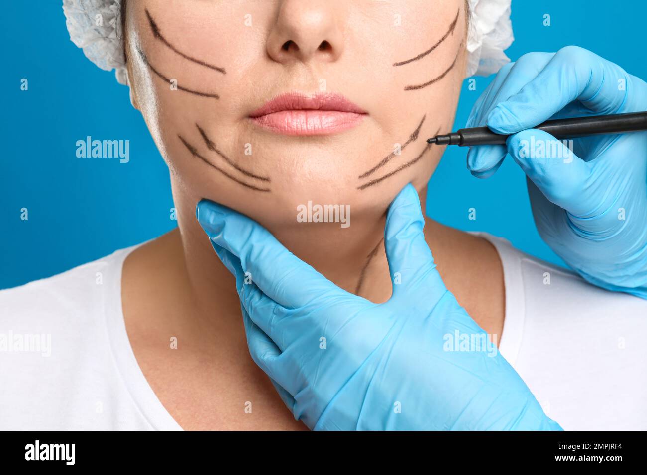 Doctor drawing marks on woman's face for cosmetic surgery operation ...