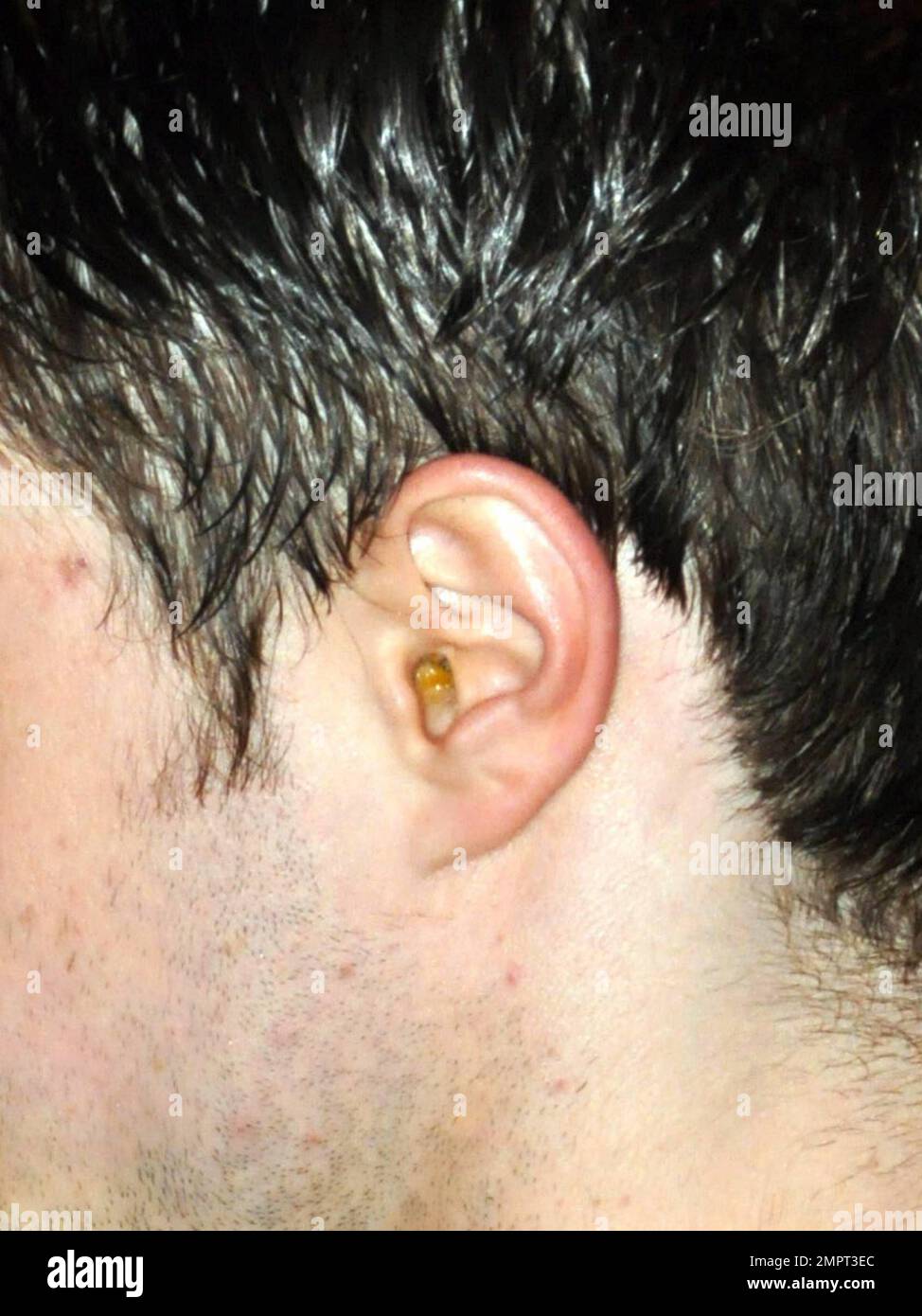 "Harry Potter and the Deathly Hallows Part 2" star Daniel Radcliffe ...