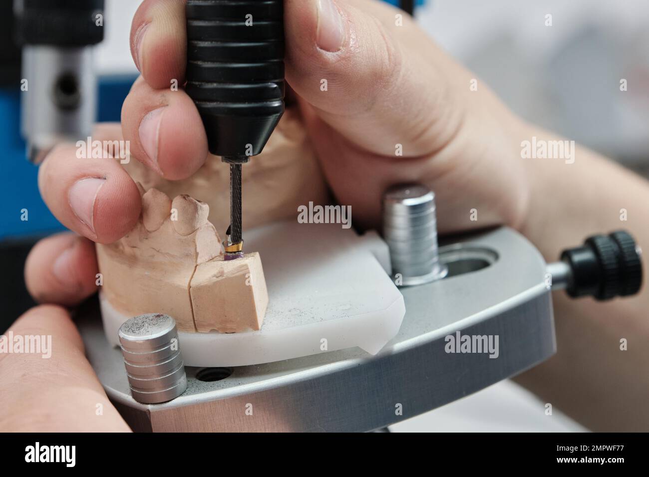 Dentist with binocular magnifying glasses working in dental clinic ...
