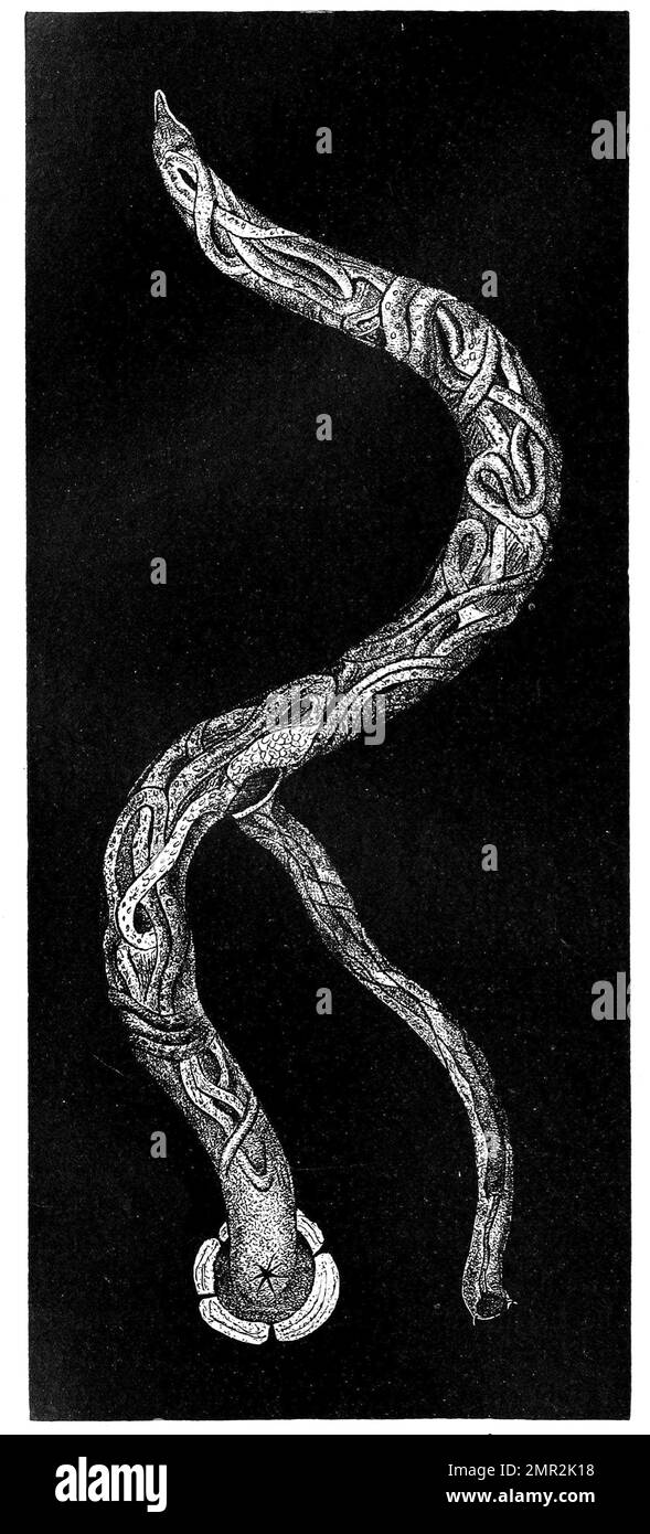 Luftröhrenwurm, Syngamus trachealis, Historisch, digital restaurierte ...