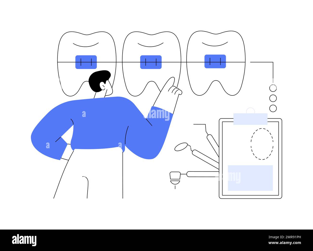 Dental braces abstract concept vector illustration Stock Vector Image ...