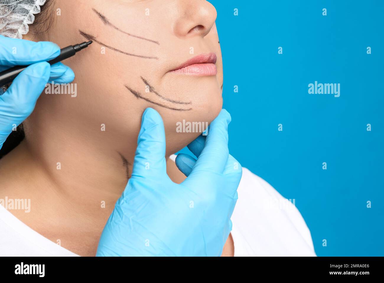 Doctor drawing marks on woman's face for cosmetic surgery operation ...