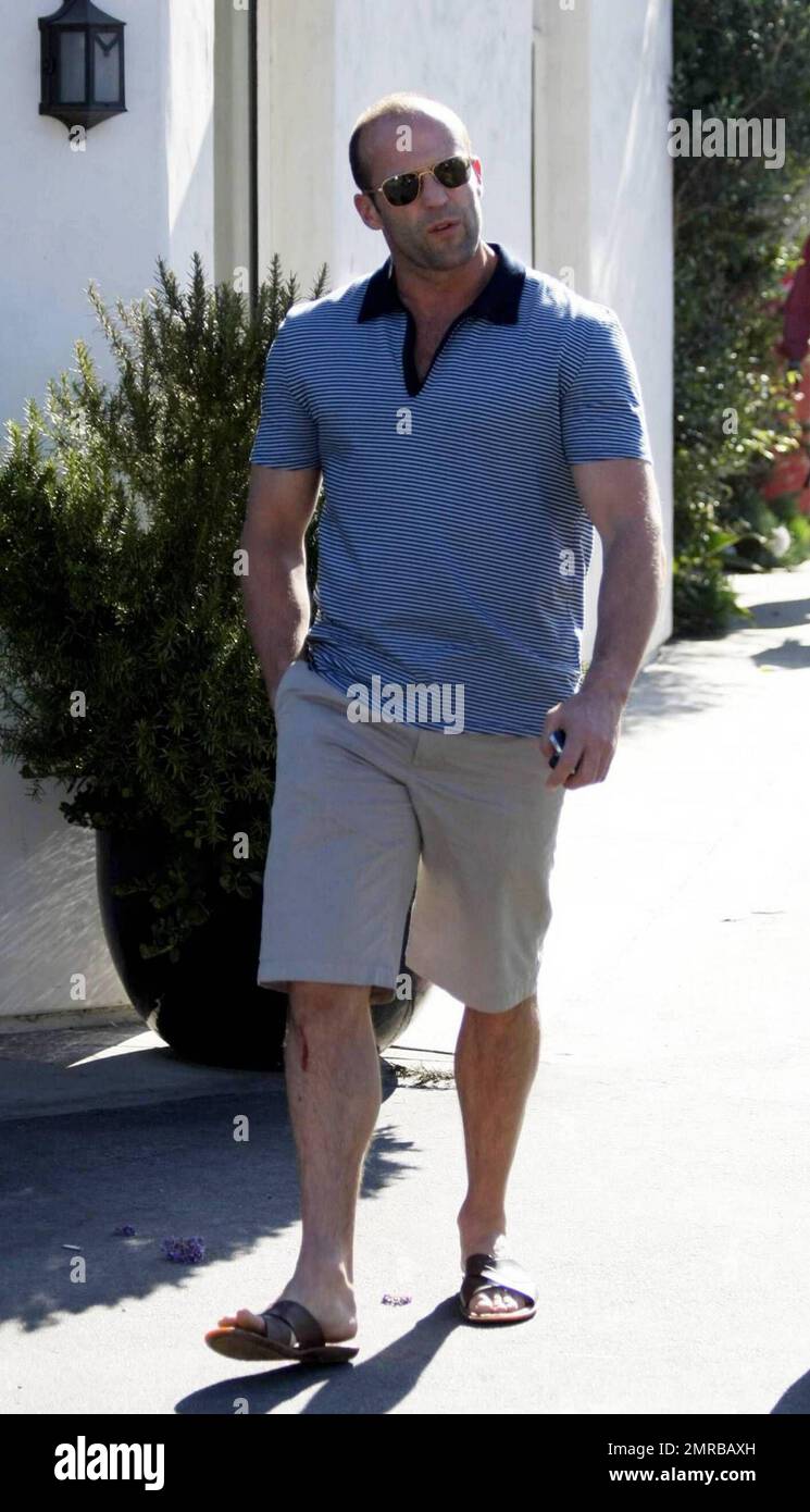 UK actor Jason Statham, sporting a large scrape beneath his knee ...