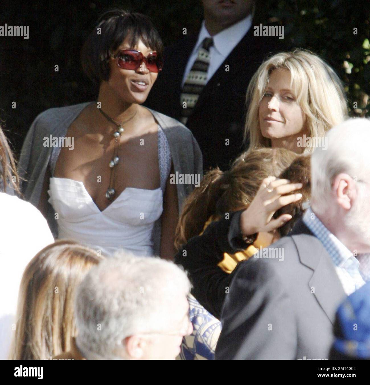 Even supermodels have skin problems. Naomi Campbell was revealing ...