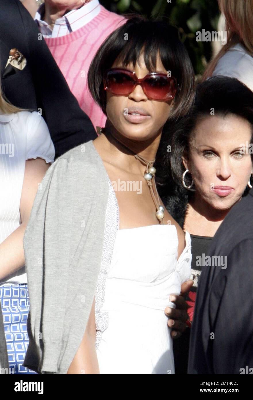 Even supermodels have skin problems. Naomi Campbell was revealing ...