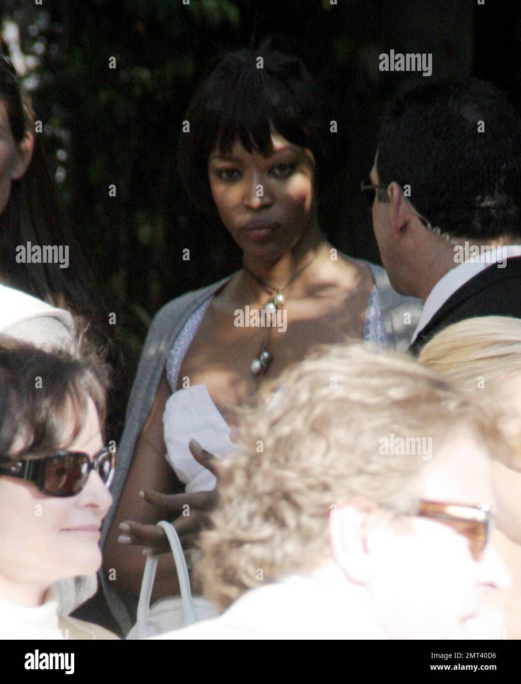 Even supermodels have skin problems. Naomi Campbell was revealing ...