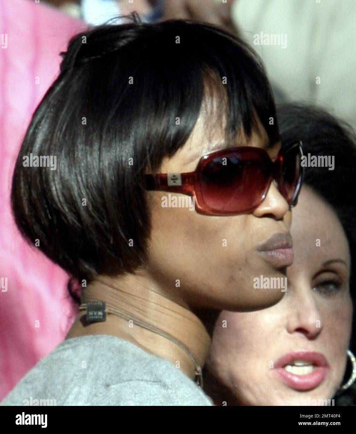 Even supermodels have skin problems. Naomi Campbell was revealing ...