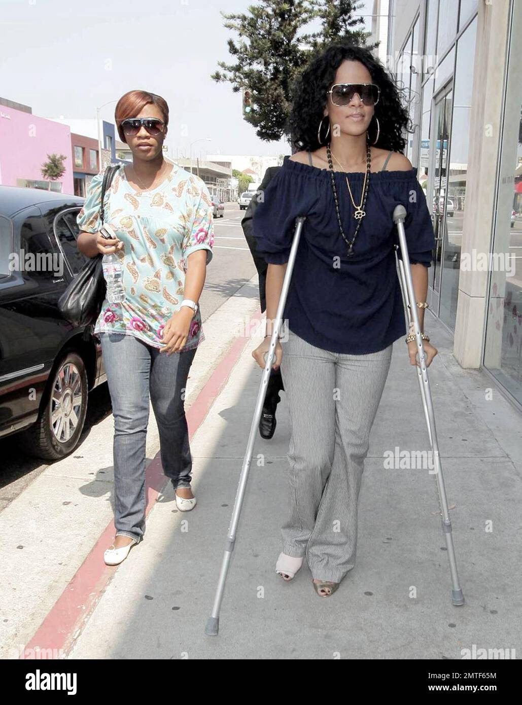 Rihanna Braces