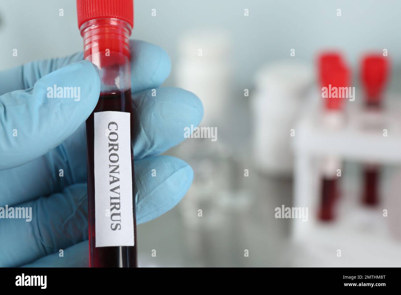 Doctor holding test tube with blood sample and label CORONAVIRUS in ...