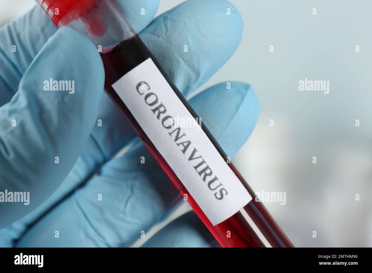 Doctor holding test tube with blood sample and label CORONAVIRUS in ...
