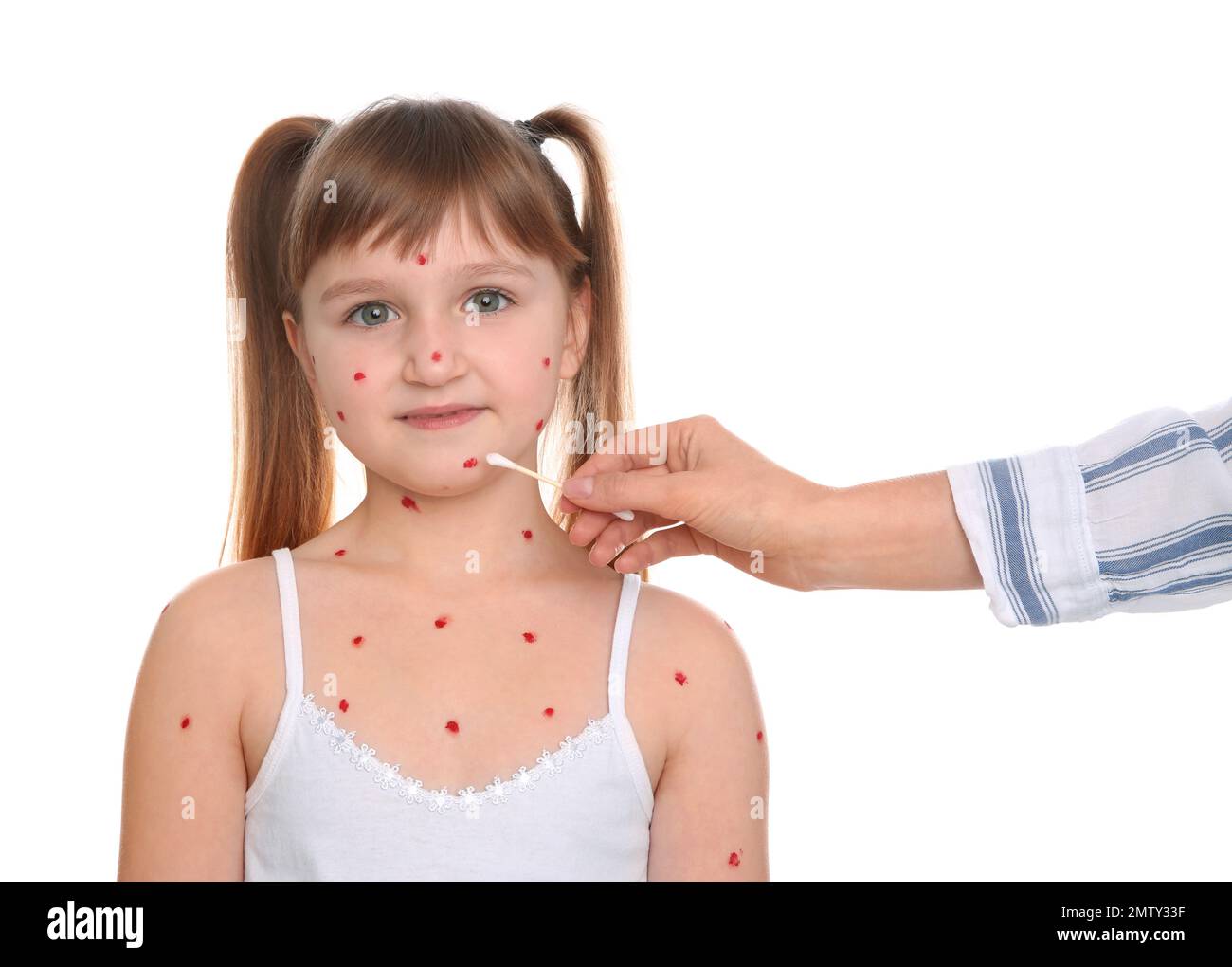 Woman applying cream onto skin of little girl with chickenpox on white ...