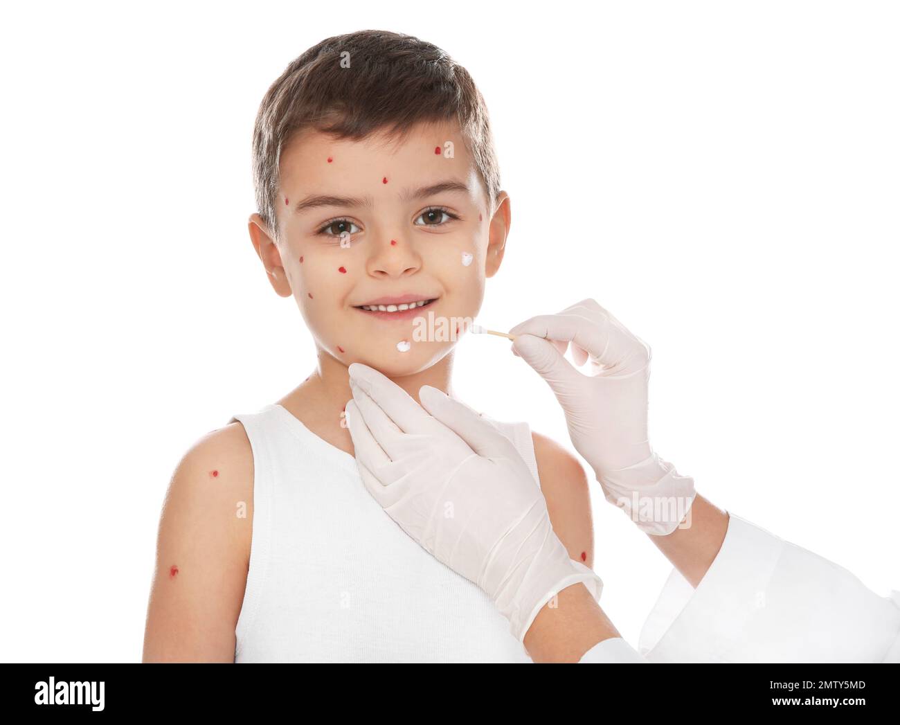 Doctor applying cream onto skin of little boy with chickenpox on white ...