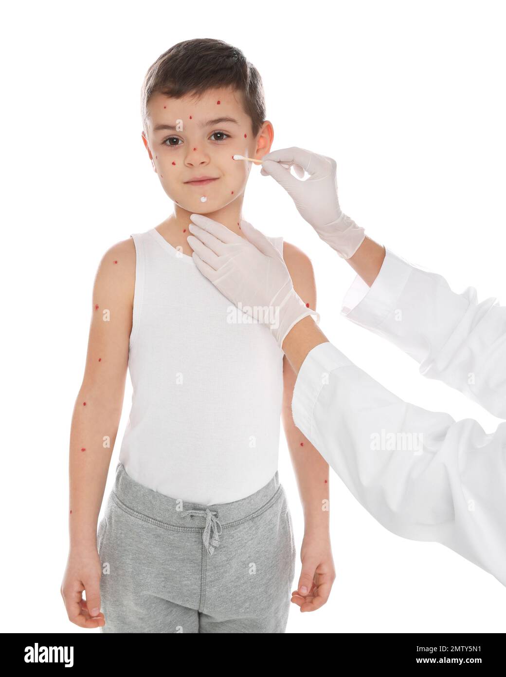 Doctor applying cream onto skin of little boy with chickenpox on white ...