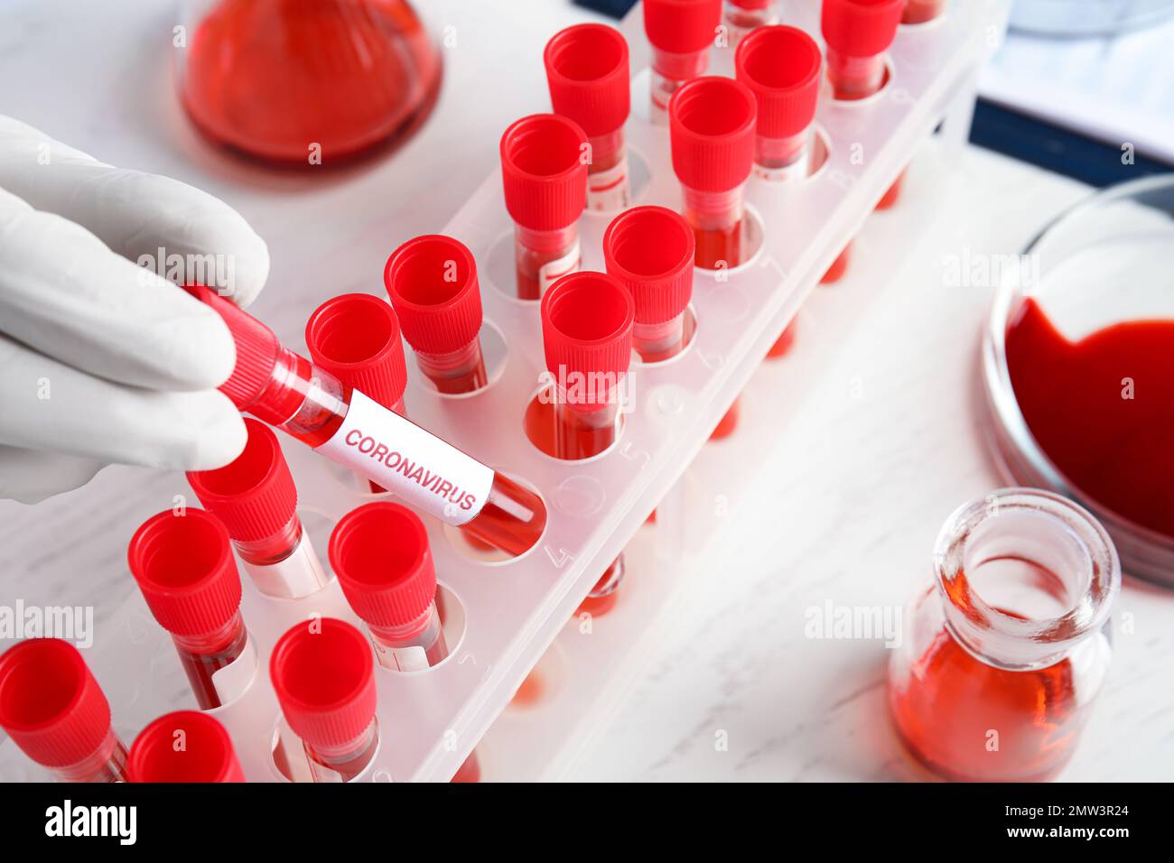 Scientist taking test tube with blood sample and label CORONA VIRUS ...