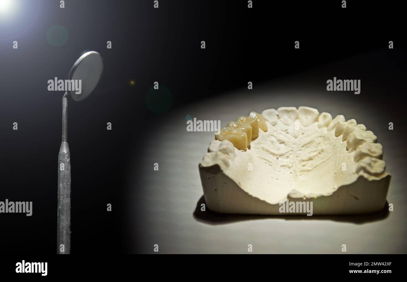 Acrylic resin prosthesis hi-res stock photography and images - Alamy