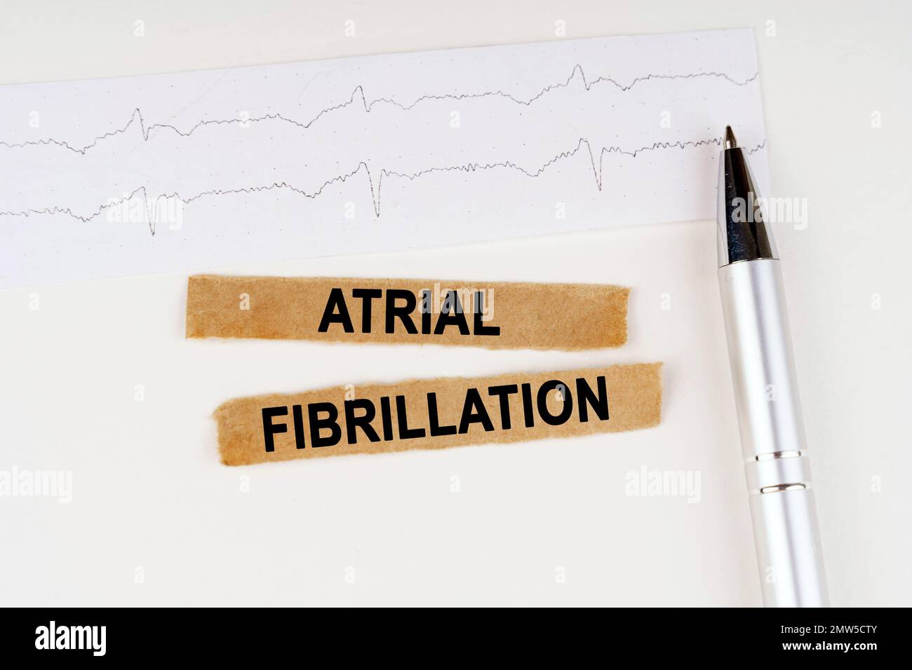 Medical concept. On the cardiogram lies a pen and torn paper with the ...