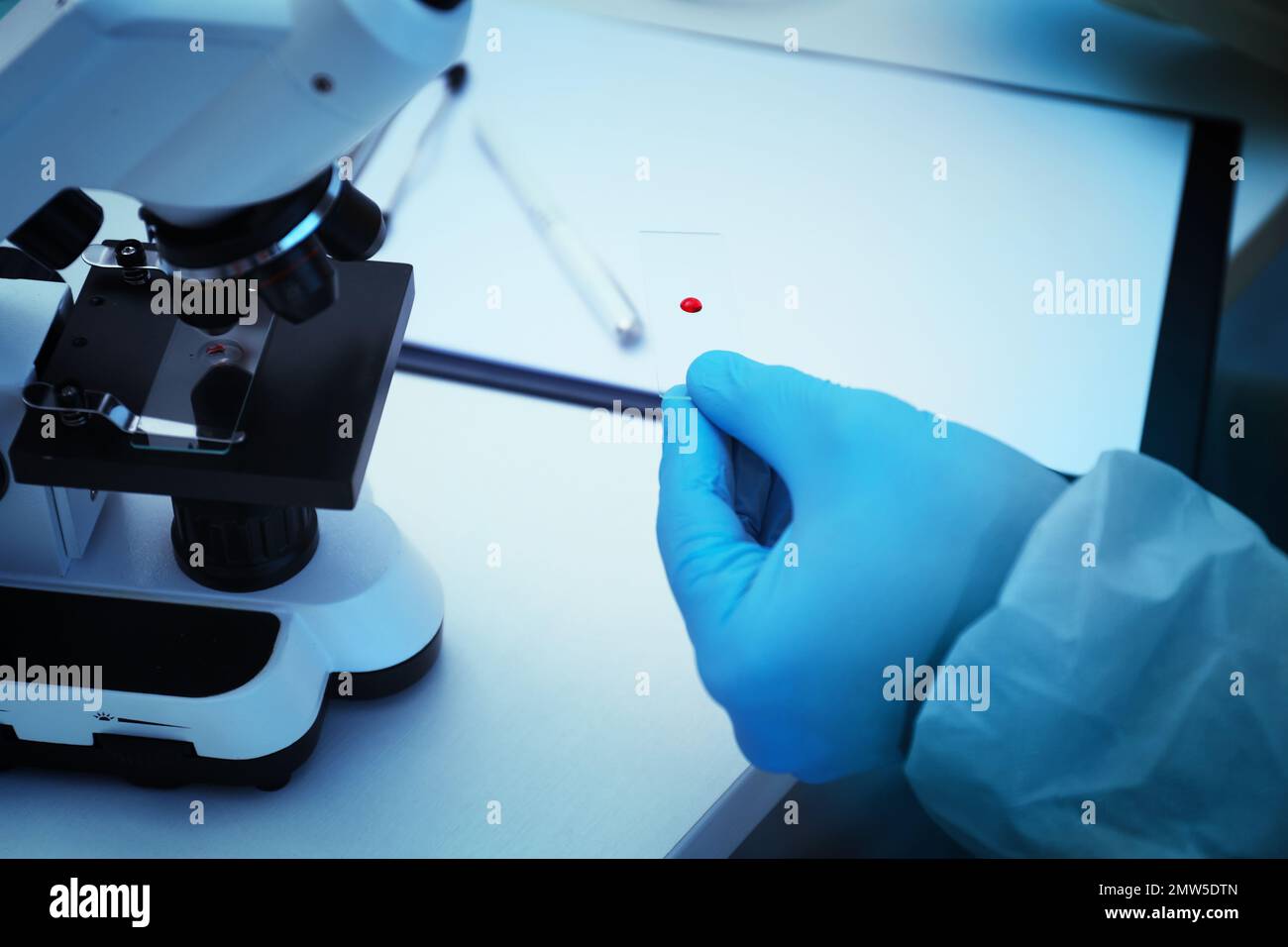 Blood sample on microscope slide hi-res stock photography and images ...