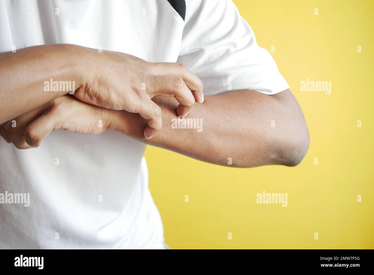 man suffering from itching skin, close up Stock Photo - Alamy