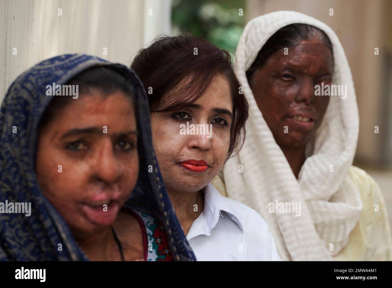 Acid attack survivors from left, Zarina Asghar, Fatima Munir and ...