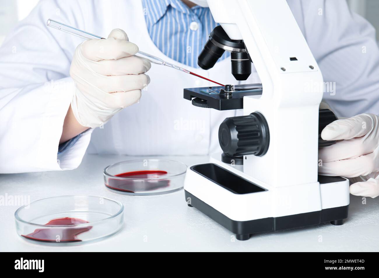 Scientist dripping blood sample onto slide on microscope in laboratory ...