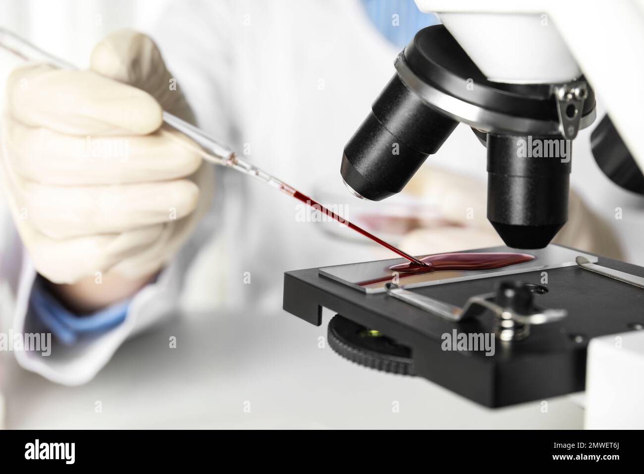 Scientist dripping blood sample onto slide on microscope in laboratory ...