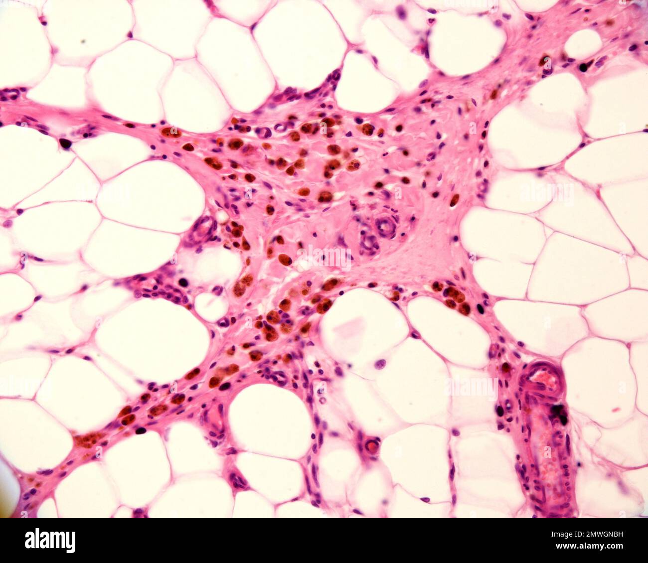 Macrophages, light micrograph Stock Photo - Alamy