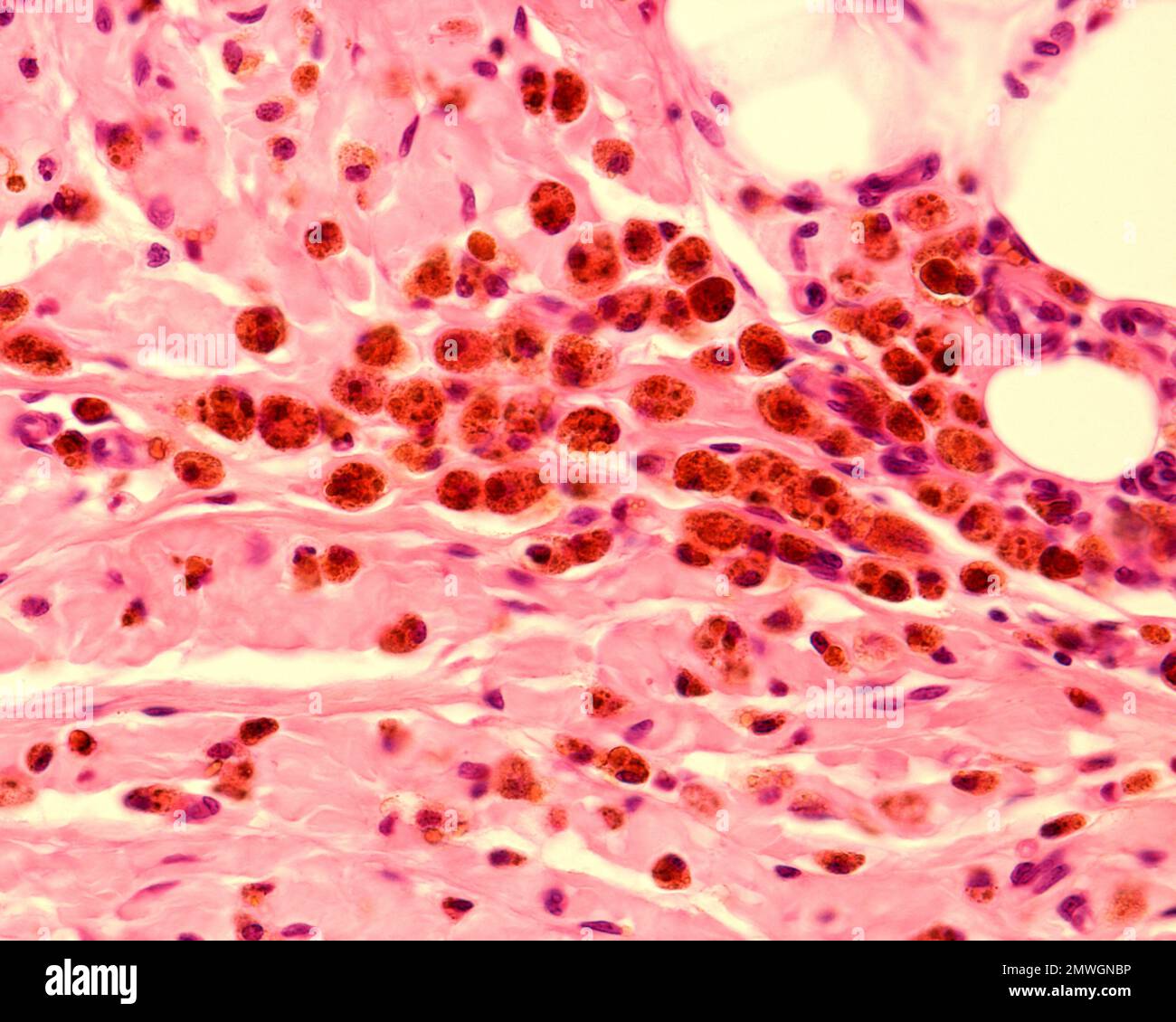 Macrophages, light micrograph Stock Photo - Alamy