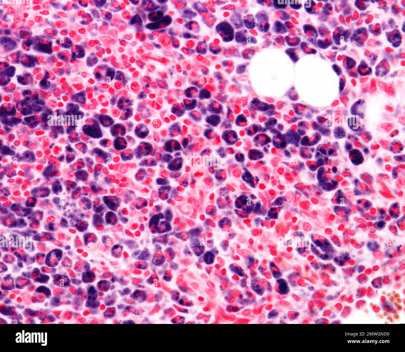 Macrophages, light micrograph Stock Photo - Alamy