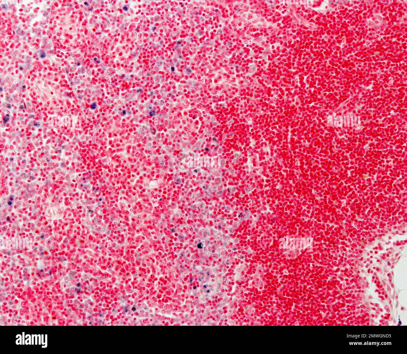 Lymph node macrophages, light micrograph Stock Photo - Alamy