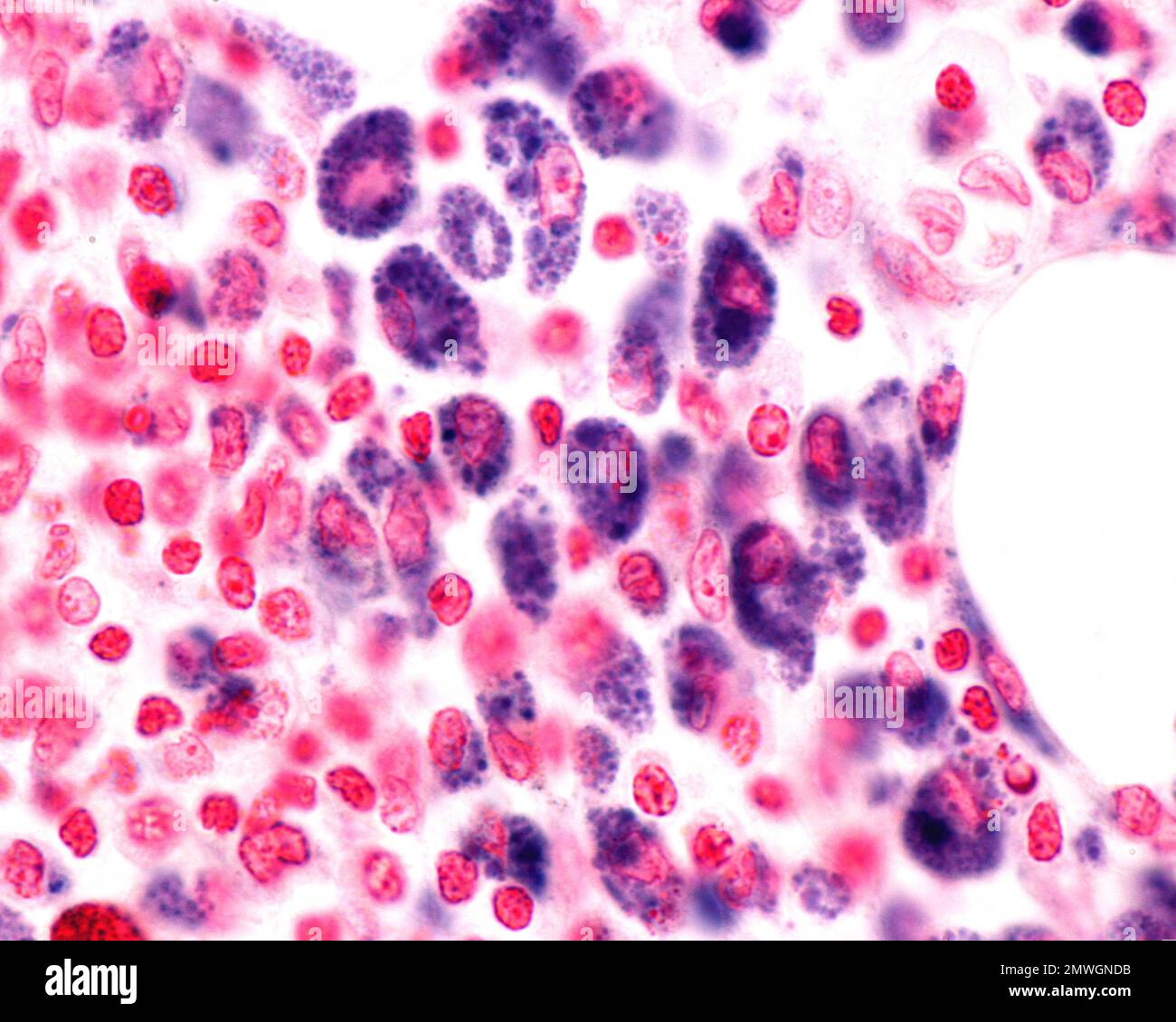 Macrophages, light micrograph Stock Photo - Alamy