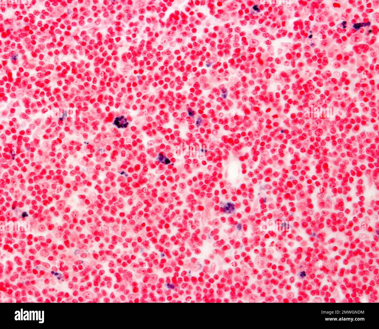 Lymph node macrophages, light micrograph Stock Photo - Alamy