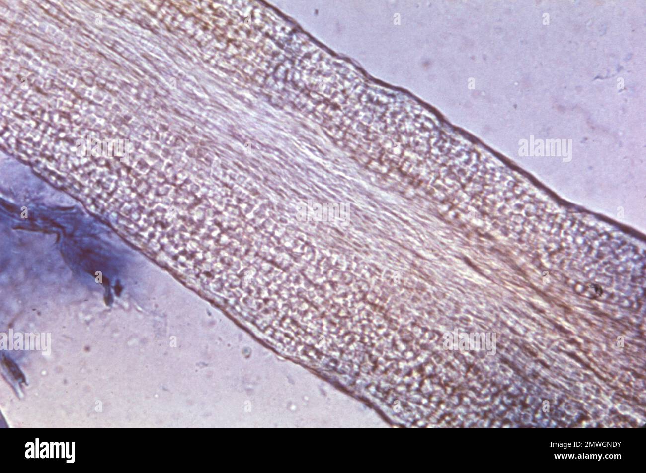 Ringworm infection, light micrograph Stock Photo - Alamy