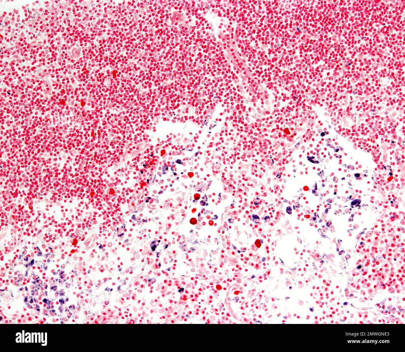 Lymph node macrophages, light micrograph Stock Photo - Alamy