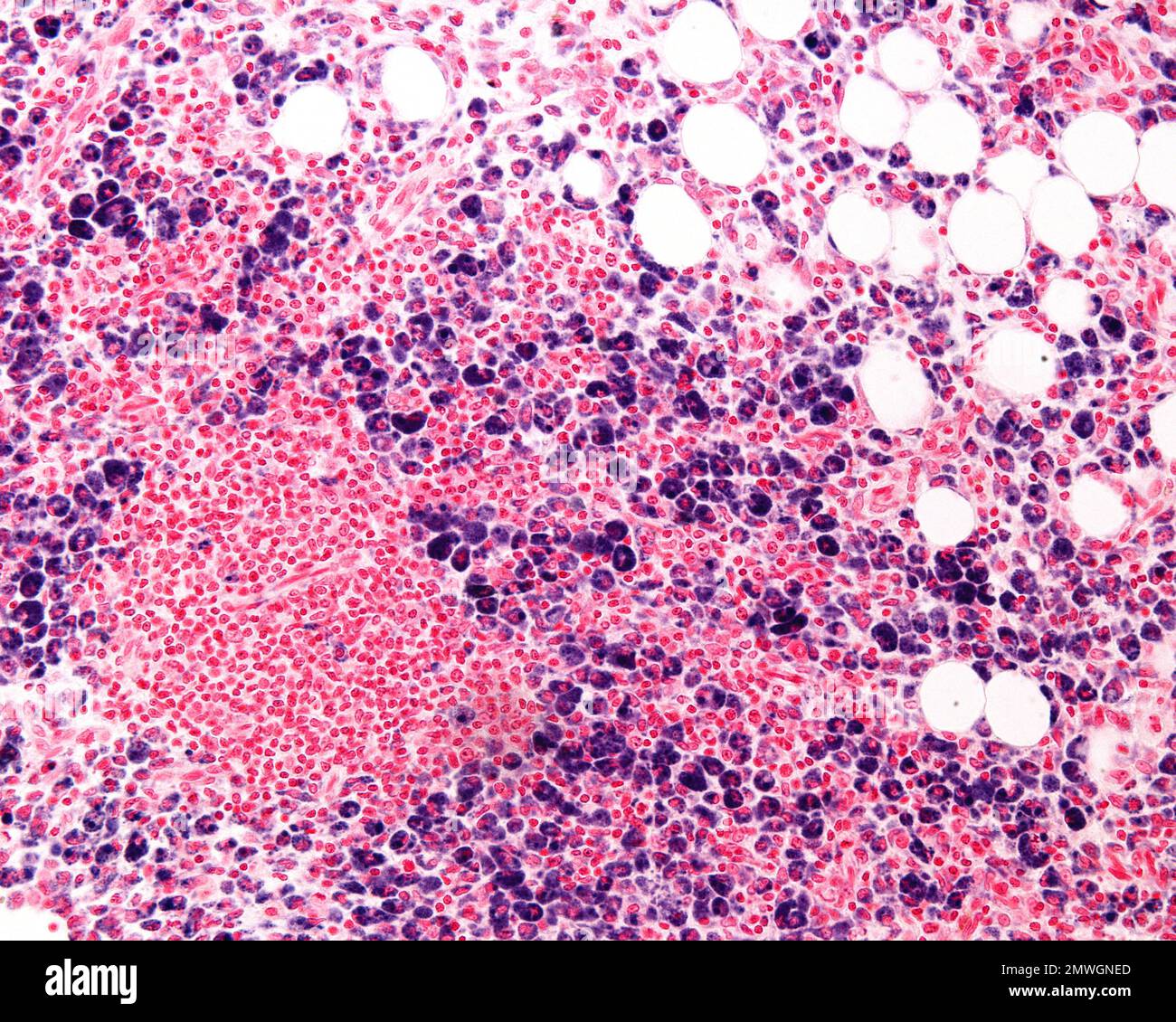 Macrophages, light micrograph Stock Photo - Alamy