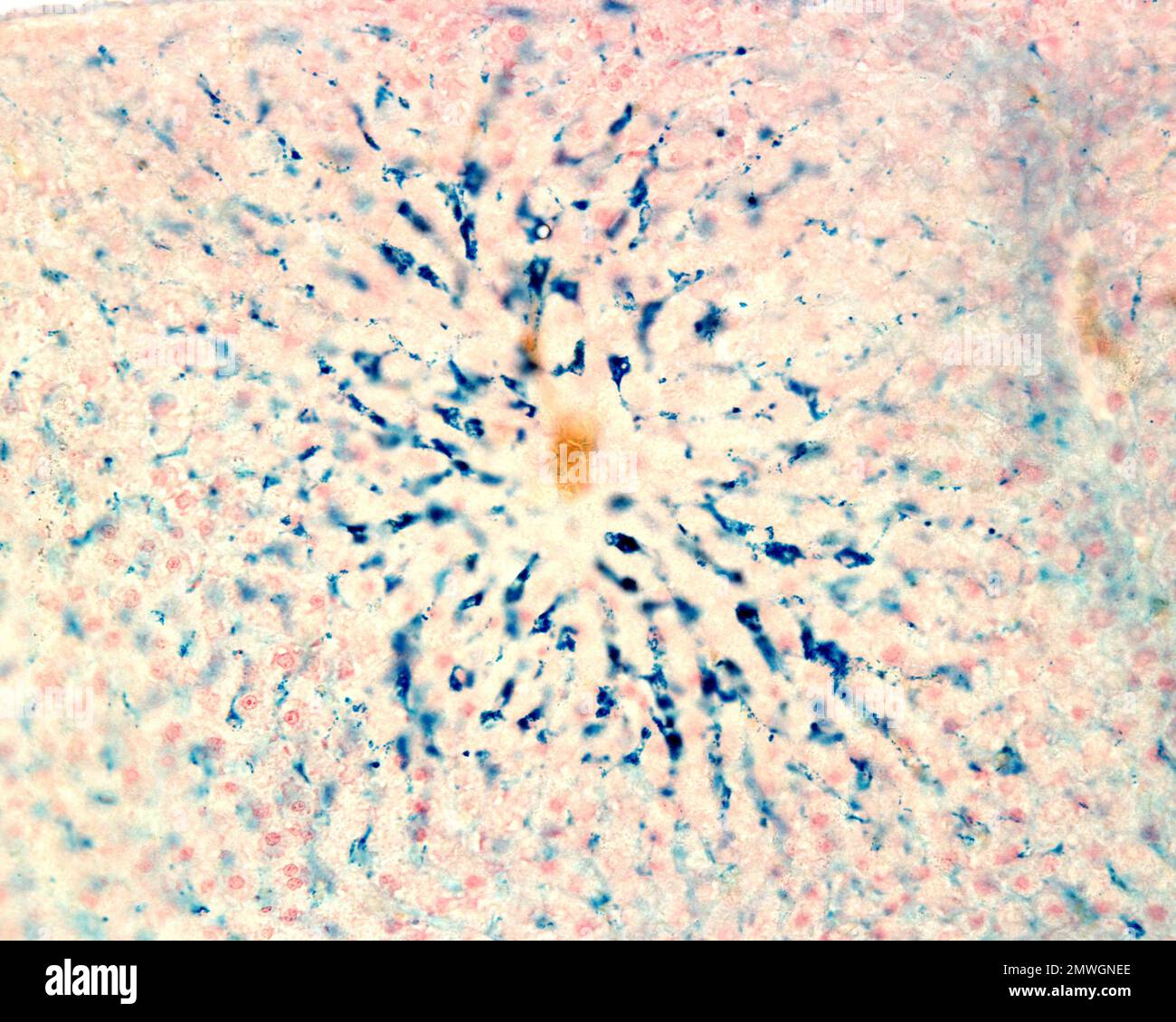 Kupffer cells, light micrograph Stock Photo - Alamy