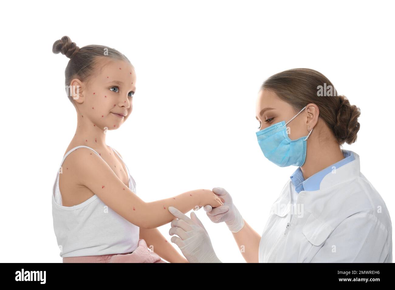 Doctor examining little girl with chickenpox on white background ...
