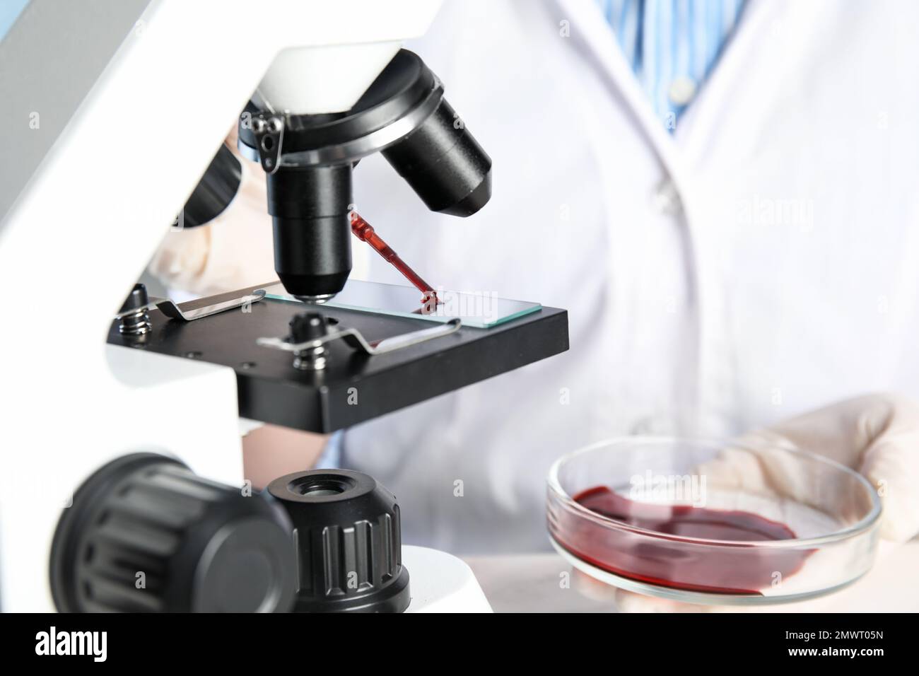 Scientist dripping blood sample onto slide on microscope in laboratory ...