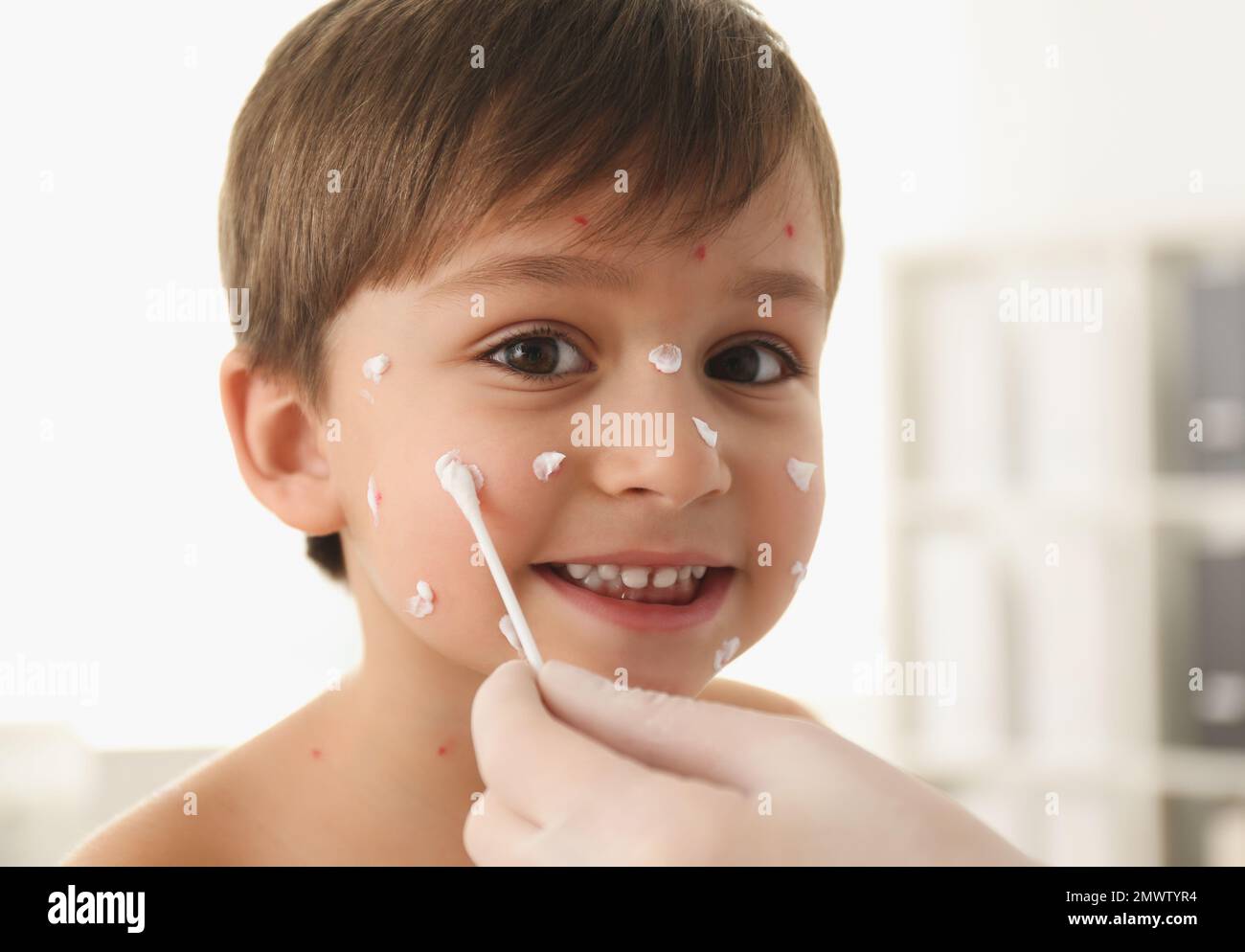 Doctor applying cream onto skin of little boy with chickenpox in clinic ...