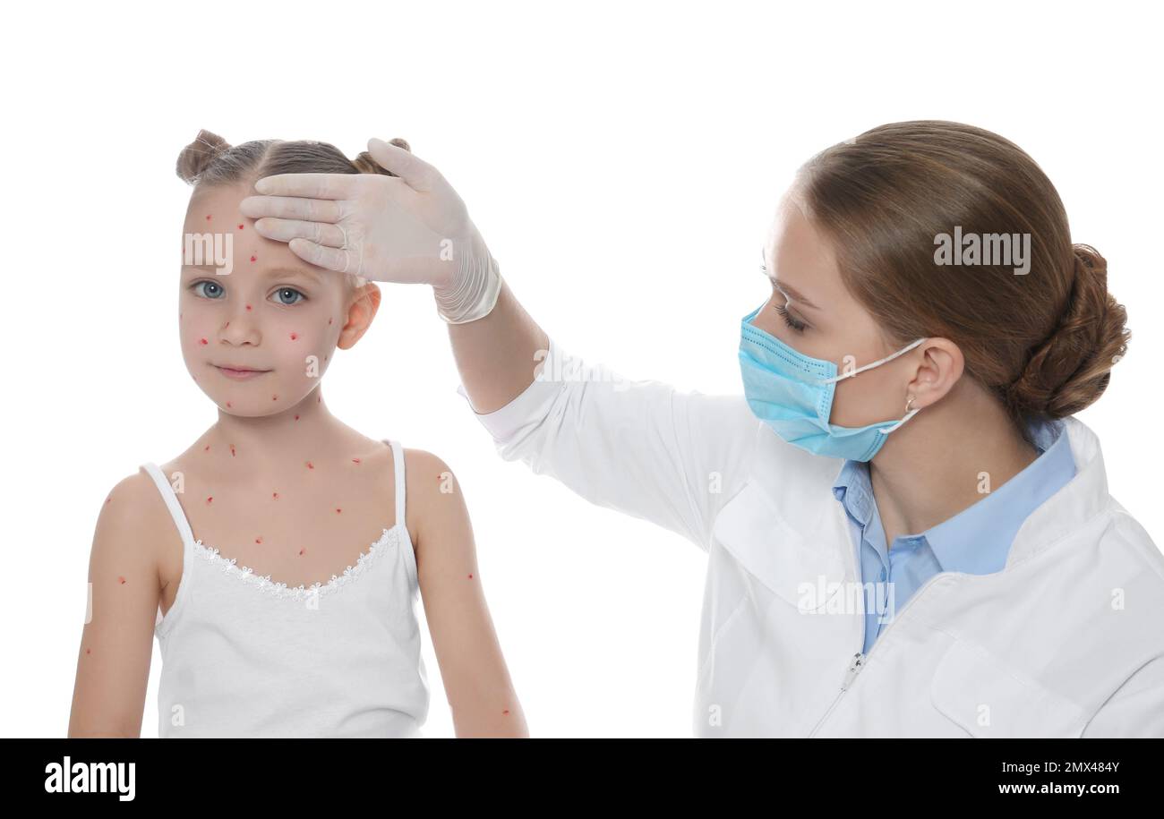Doctor examining little girl with chickenpox on white background ...
